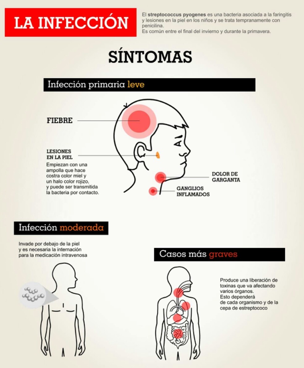 Preguntas y respuestas sobre la bacteria streptococcus pyogenes